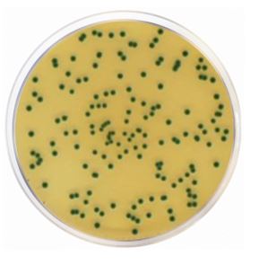 Condalab - ISO- 1446 - Microbiology - Chromogenic Culture ...