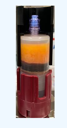 Mdbiologix Lipopro System For Harvesting Of Adipose Tissue